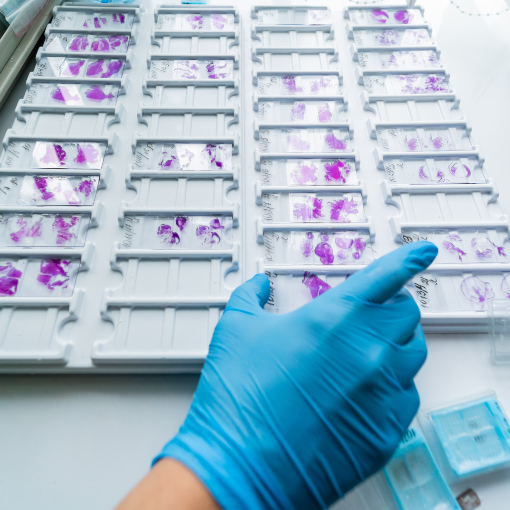 Tumor Markers Screening for Early Detection | FOMAT Medical